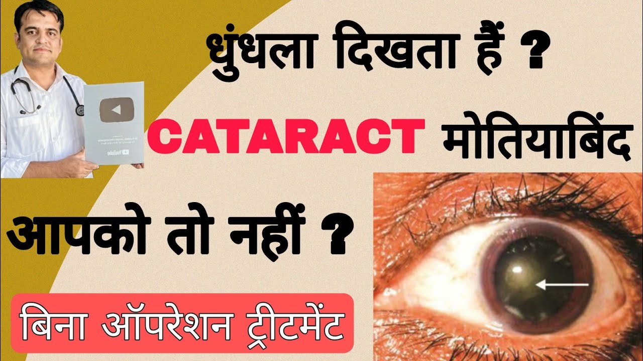 मोतियाबिंद Cataract क्या हैं । मोतियाबिंद के लक्षण और बिना ऑपरेशन ...