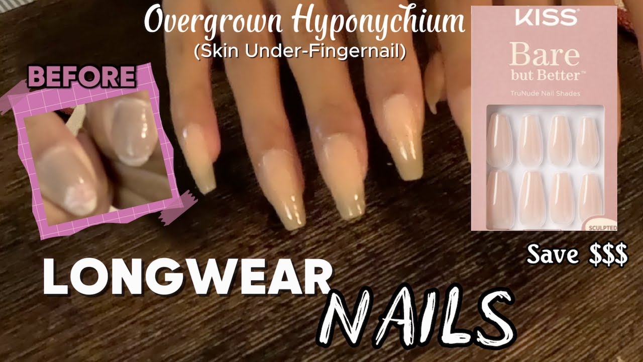 HOW TO APPLY PRESS ON NAILS | HYPONYCHIUM | SKIN UNDER NAILS JOURNEY ...