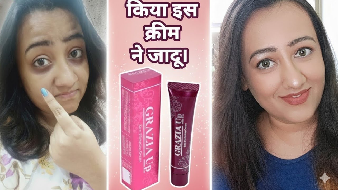 शरीर के काले अंगों को करे गोरा ! Grazia Up Cream Usage & Benefits! Say ...