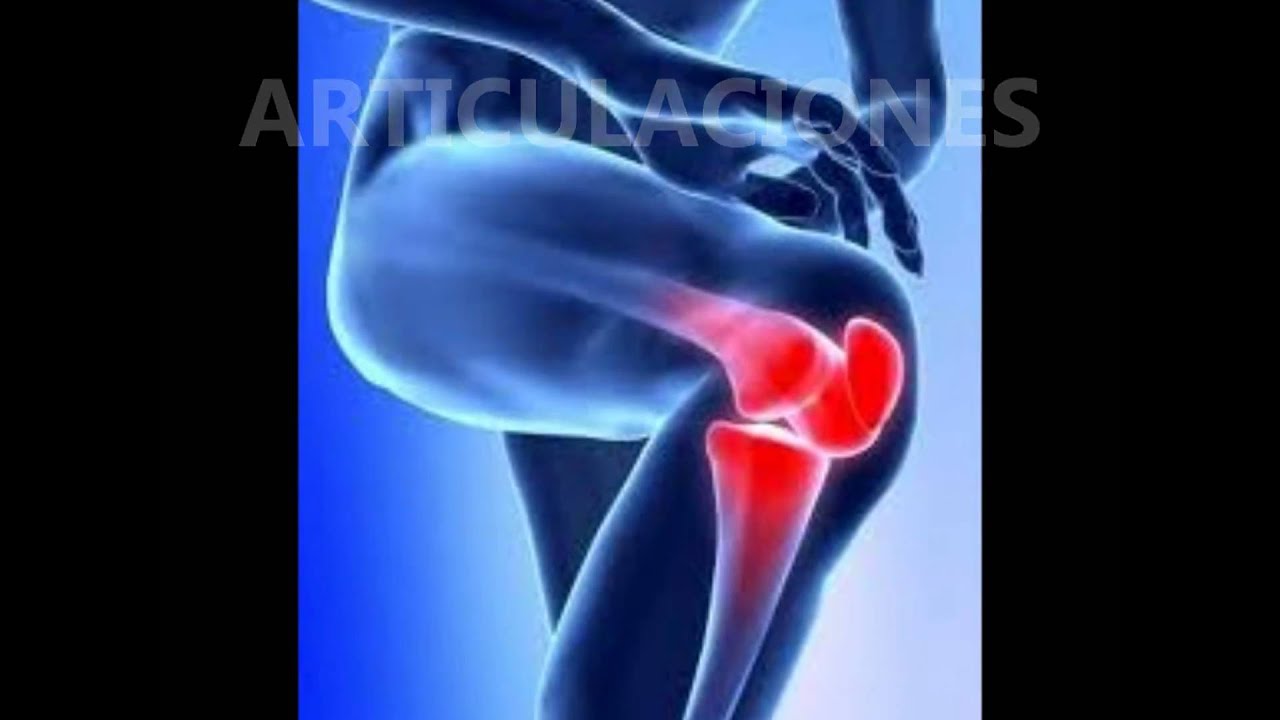 UNGÜENTO ERILIM (efecto caliente) Auxiliar en Artritis. www.erilim.com ...