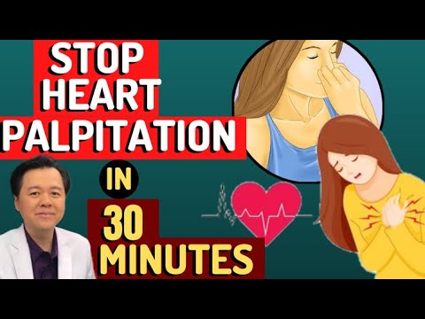Stop Heart Palpitation in 30 Minutes - By Doc Willie Ong (Internist and ...