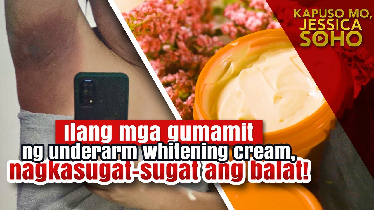Ilang gumamit ng underarm whitening cream, nagkasugat-sugat ang ...