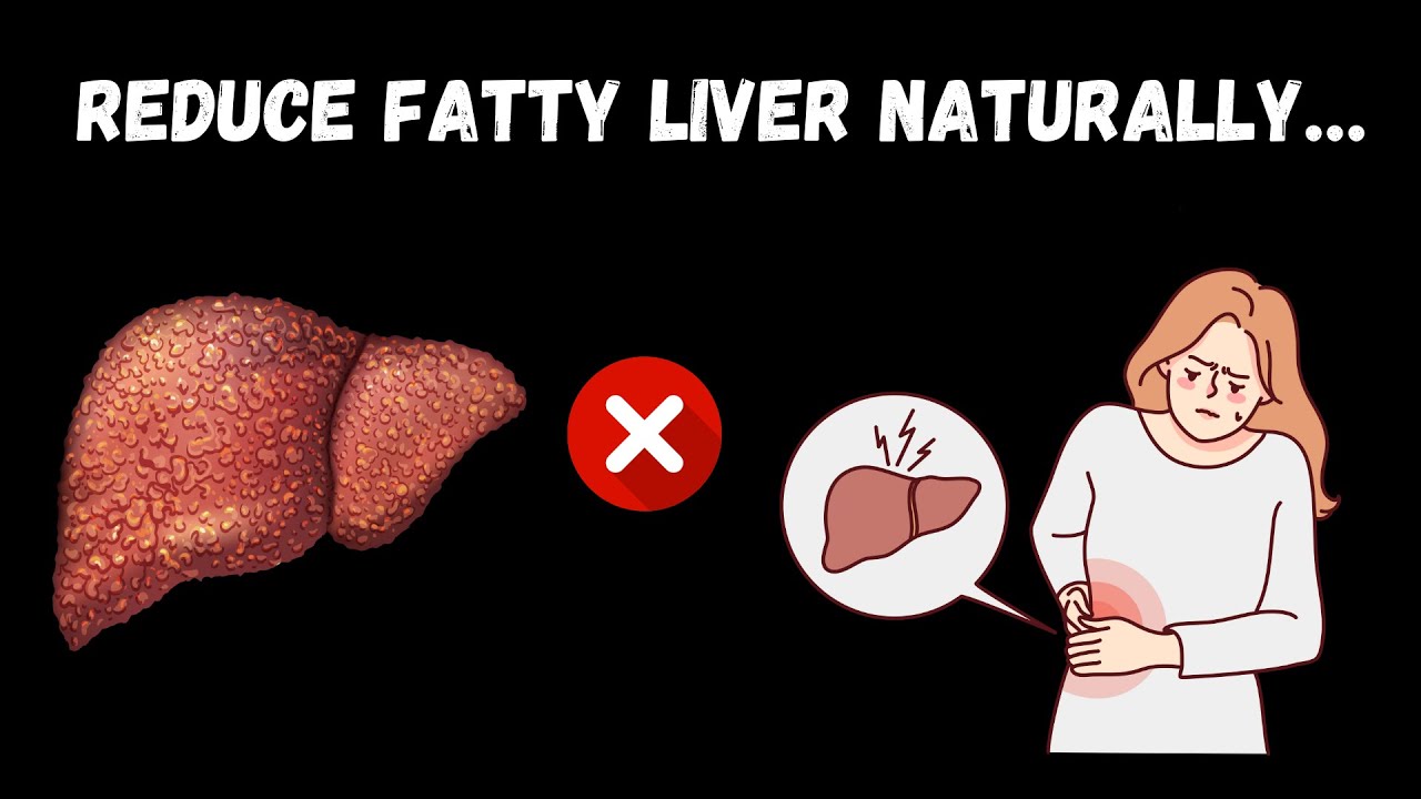 TIPS TO REDUCE FATTY LIVER NATURALLY | Detox Fatty Liver Naturally ...
