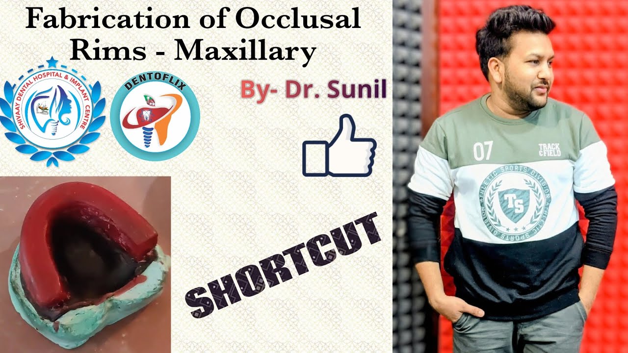 Preclinical Prosthodontics: Fabrication of Occlusal Rims- Maxillary ...