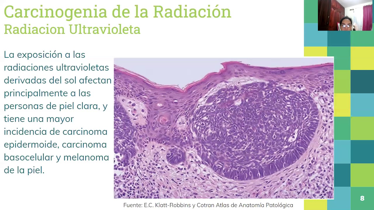 Secc: 02 Agentes Carcinogenos - YouTube