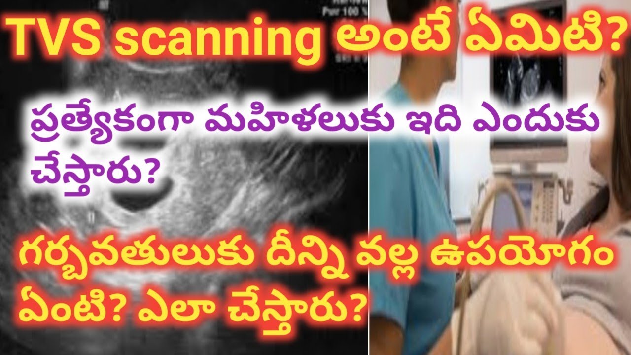 tvs scan/transvaginal ultrasound during pregnancy - YouTube