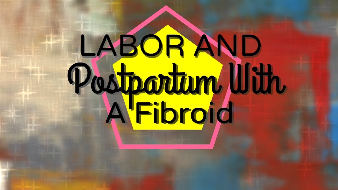 Fibroid Update: Labor and Delivery, Postpartum - YouTube