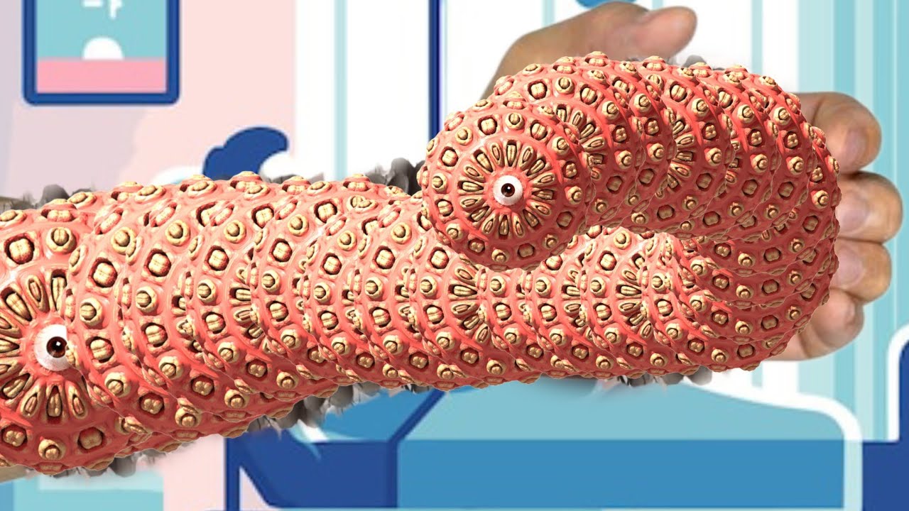 ASMR sleep trypophobia Removal crab 🦀 treatments Hand | ASMR animation ...