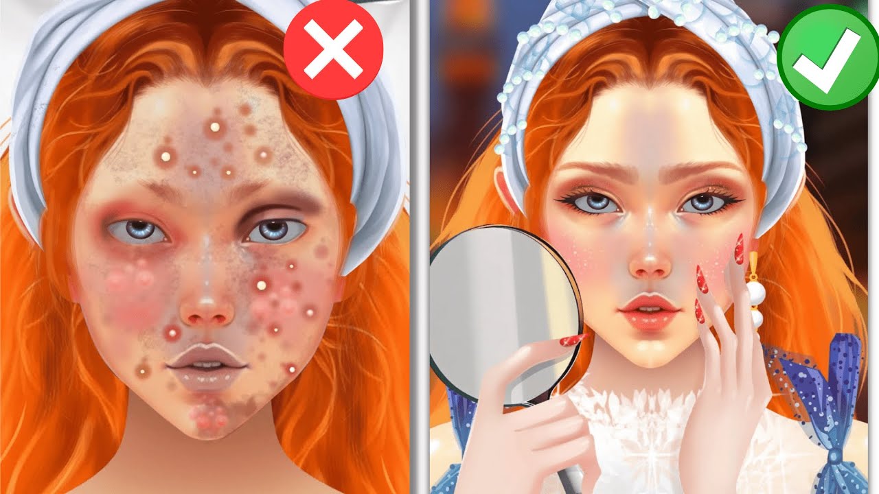 ASMR Satisfying Juicy Pimple Extraction, transformation makeup, Facial ...