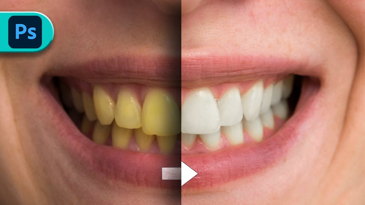 Photoshop Tutorial: Master the Art How To Realistic way to whiten teeth ...