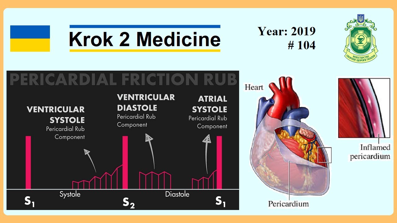 [ Krok 2 Medicine ] Year: 2019 - 104 (Ministry of Public Health of ...