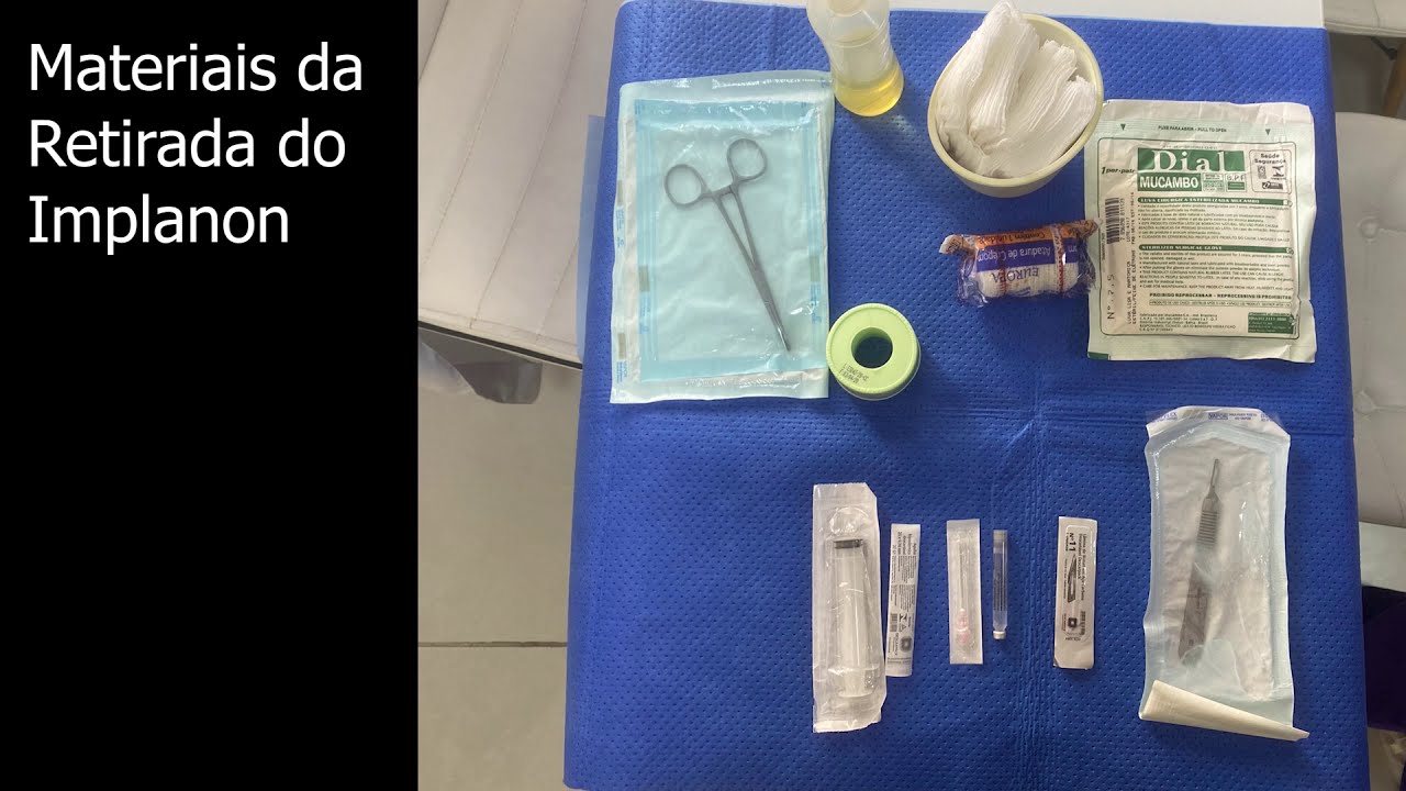 Retirada de Implanon NXT: como é a retirada do chip contraceptivo ...