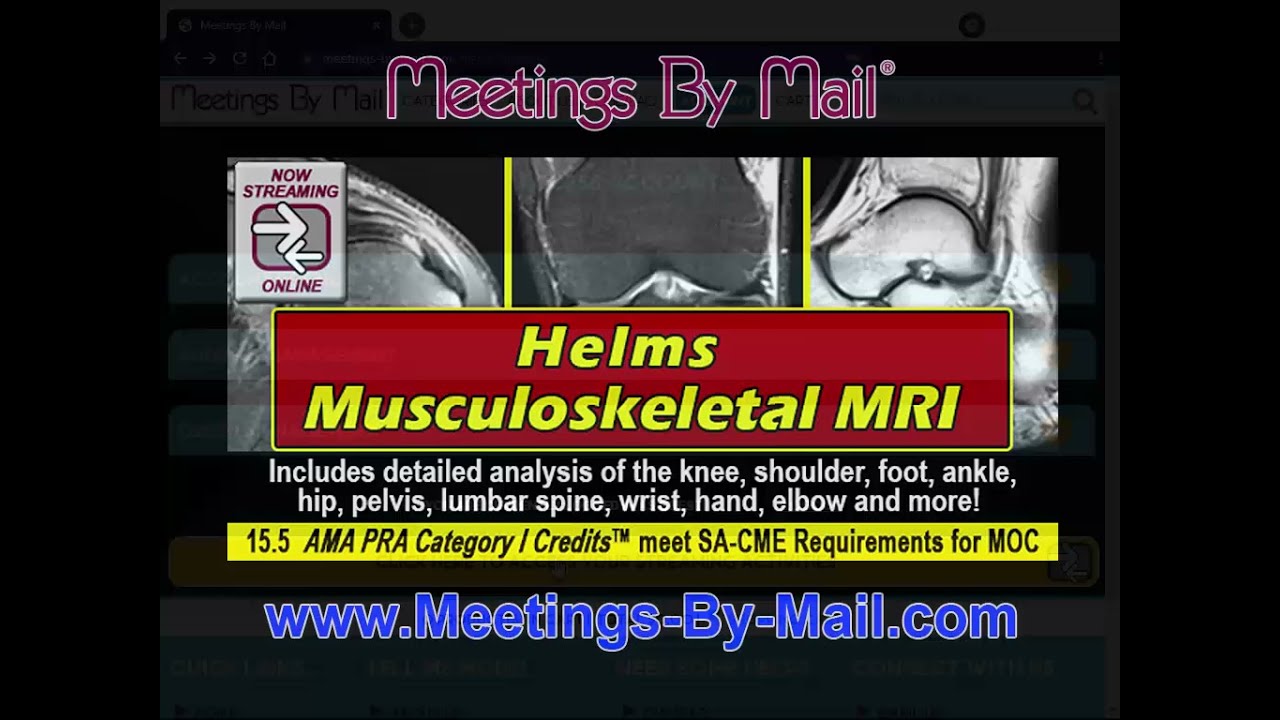 Helms Musculoskeletal MRI Preview - YouTube