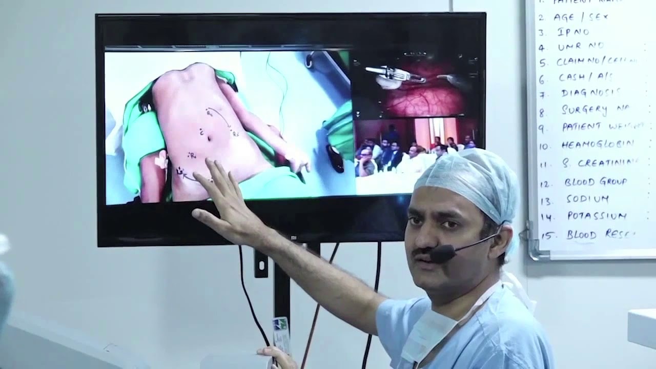 Robotic LAR Vizac Liver surgery Vizac MGOncoCon July 7 2019with audio ...