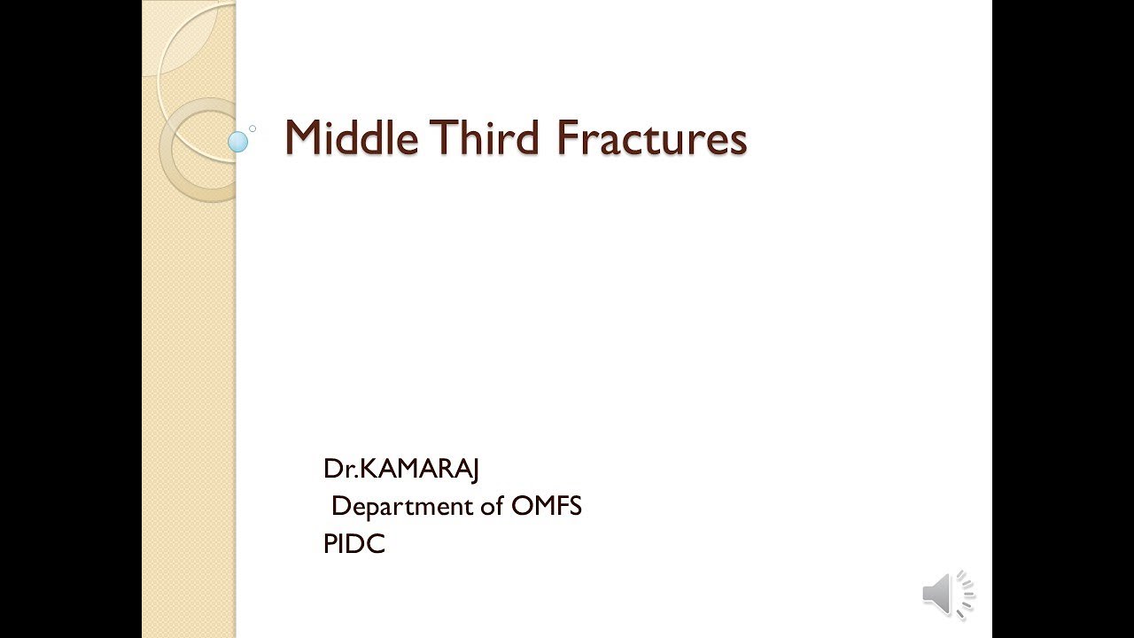 Middle Third Fractures - YouTube