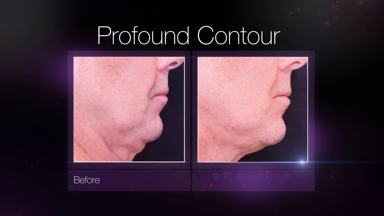 Profound Introduction - YouTube