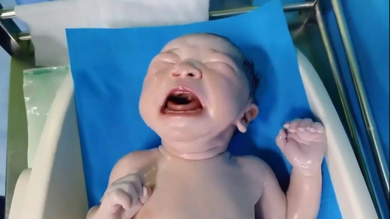 LIVE BIRTH VLOG | baby C-SECTION DELIVERY | The newborn baby crying is ...