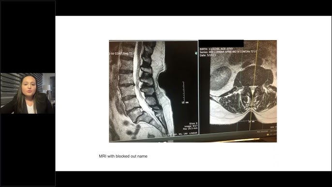 Typical Mri Lumbar Spine Interpretation Process Youtube