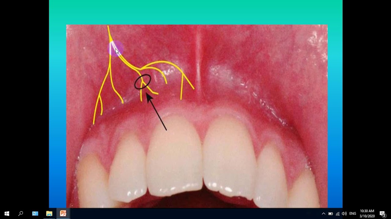 Basic Techniques Of Local Anesthesia - YouTube