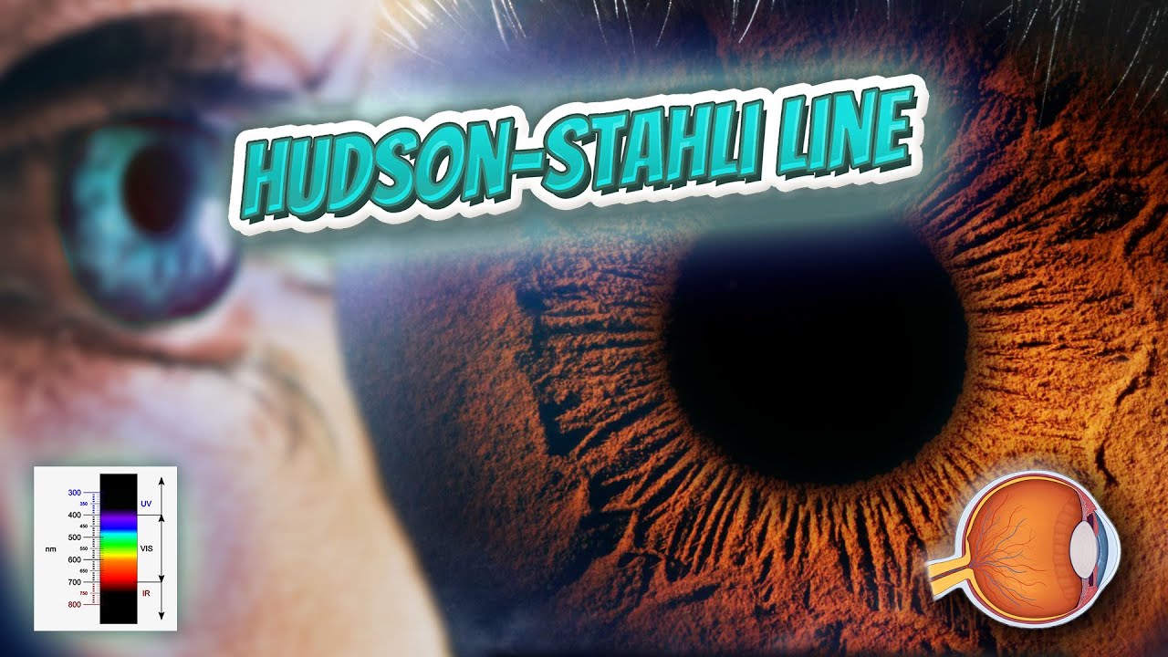 Hudson–Stahli line (Your EYEBALLS) 👁️👁️💉😳💊🔊💯 - YouTube
