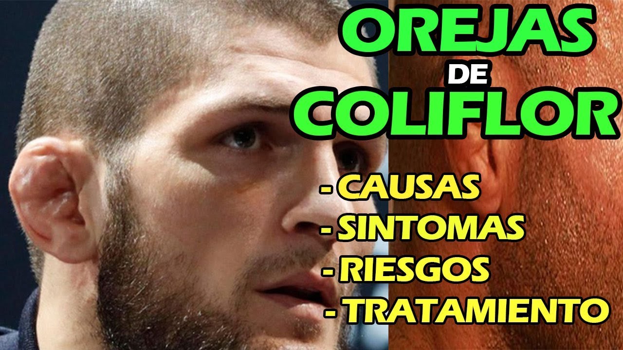 ¿QUE SON LAS OREJAS DE COLIFLOR? - Causas, Síntomas, Riesgos y ...