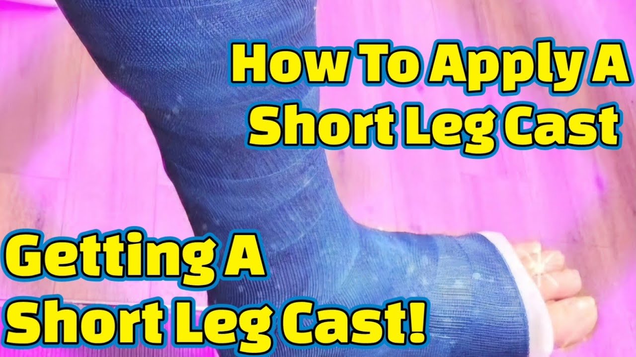 Getting A Short Leg Cast! How To Apply A Short Leg Cast Step By Step ...