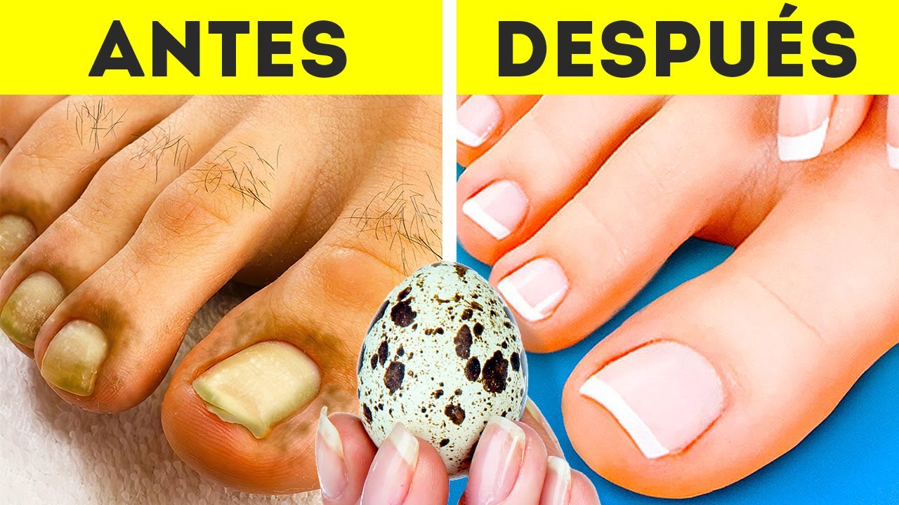 ¡INCREÍBLES TRUCOS PARA PIES Y ZAPATOS QUE DEBES CONOCER! - YouTube