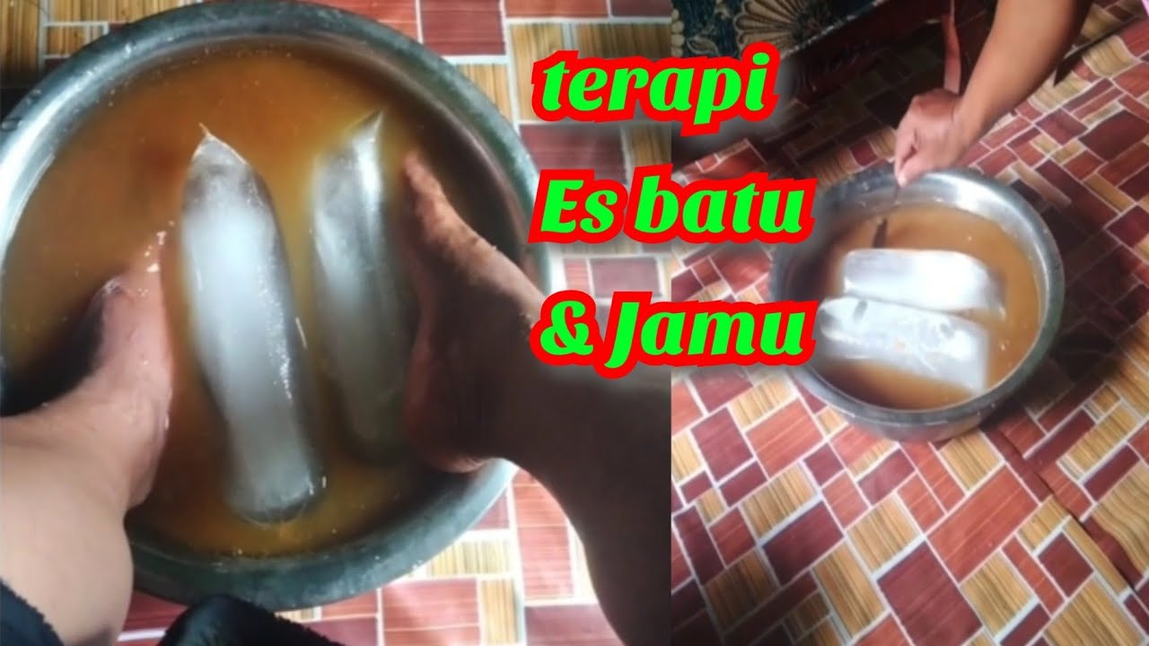 Terapi Rendam Kaki dengan Jamu dan ES batu @PIJATAMALIAMAMUJU - YouTube