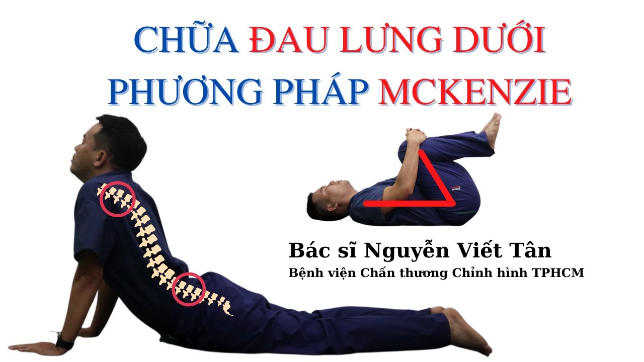 Chữa đau lưng dưới bằng phương pháp Dr. Mckenzie ( Mckenzie method ...