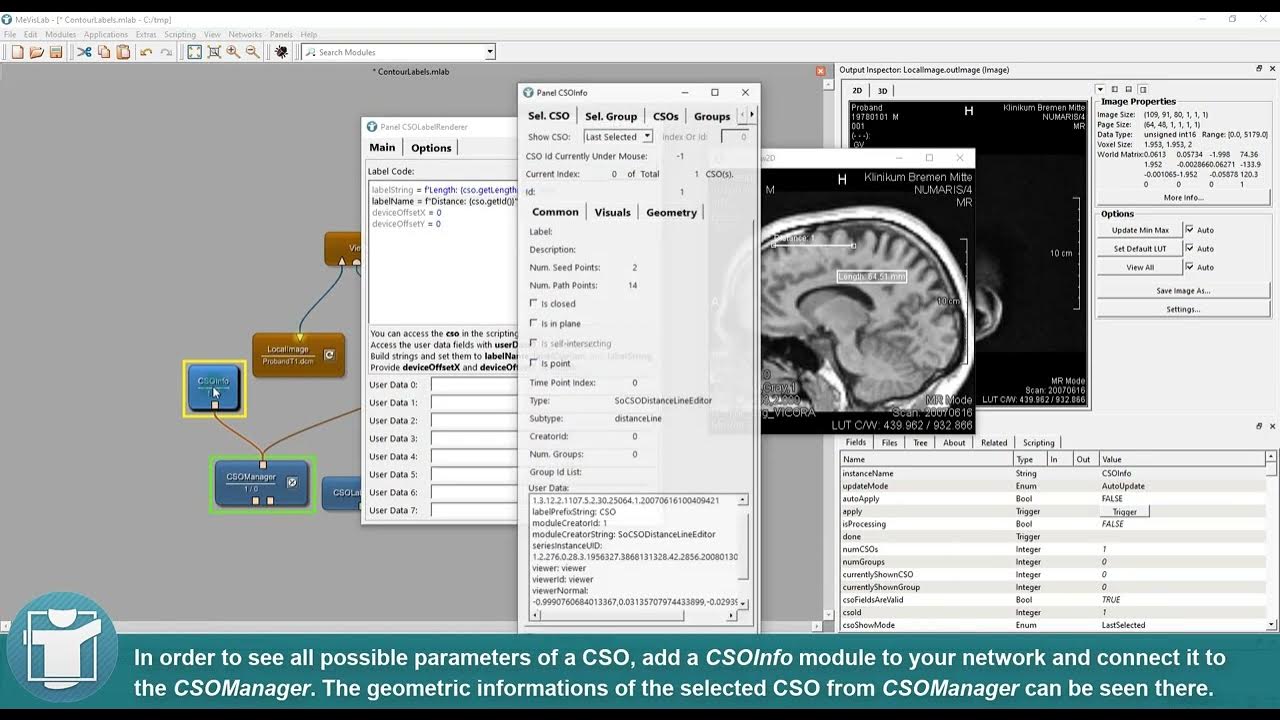 MeVisLab Tutorials - Contours - Create Labels on Contours - YouTube