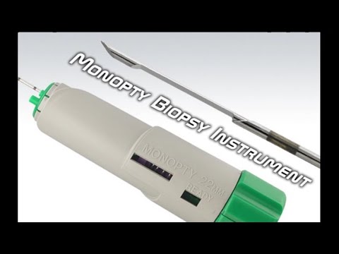 (Monopty Biopsy Instrument) Complete Procedure Monopty Biopsy ...