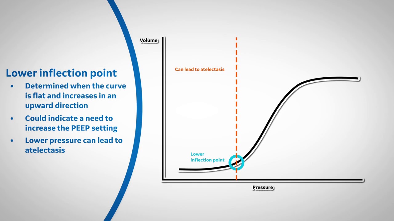 GE Healthcare Visualizing Lung Compliance with CARESCAPE R860 I NAVAMED ...