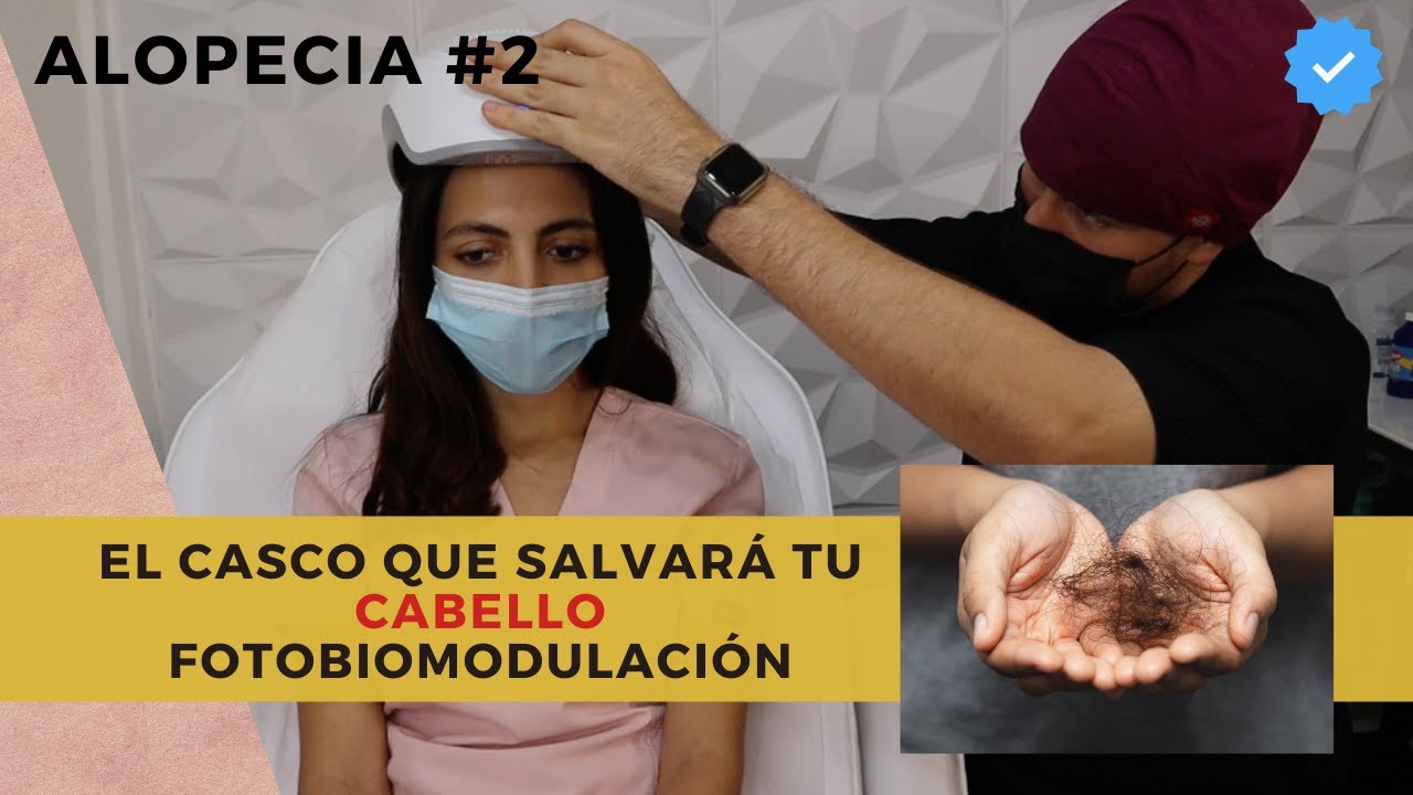 #ALOPECIA 2: CASCO LED PARA FRENAR LA CAIDA DE #CABELLO ¿FUNCIONA? / # ...