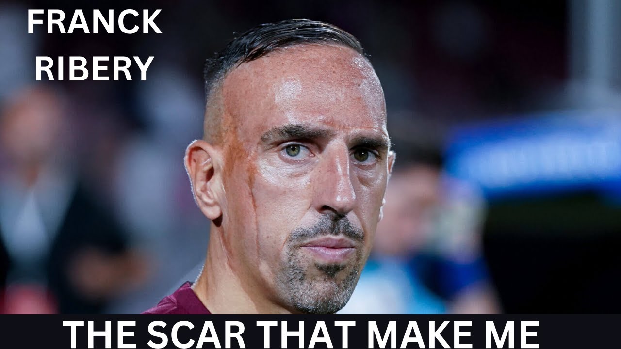Franck Ribéry The Scar That Made Me 2024 - YouTube