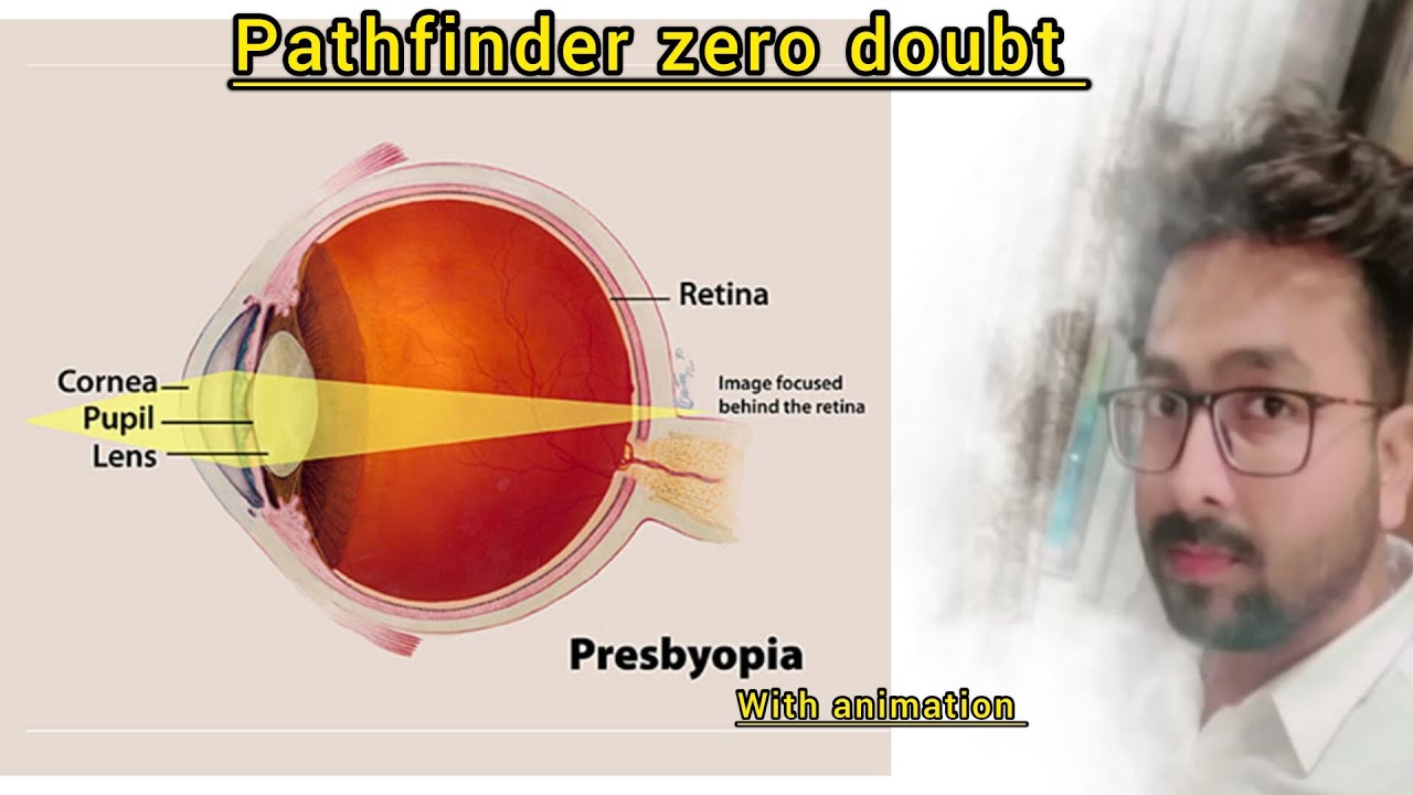 Human Eye and Colourful World Class 10 (Animation) | Defect of vision ...