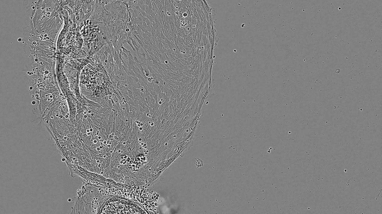 Formation of a monolayer of pancreatic ductal epithelial cells from ...
