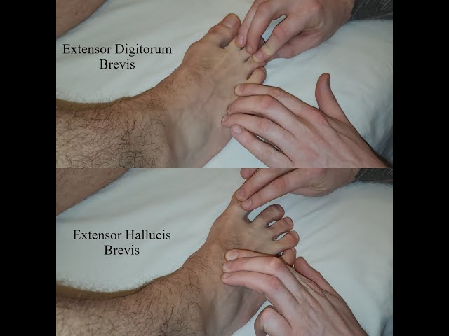 Extensor Hallucis Brevis Tendon