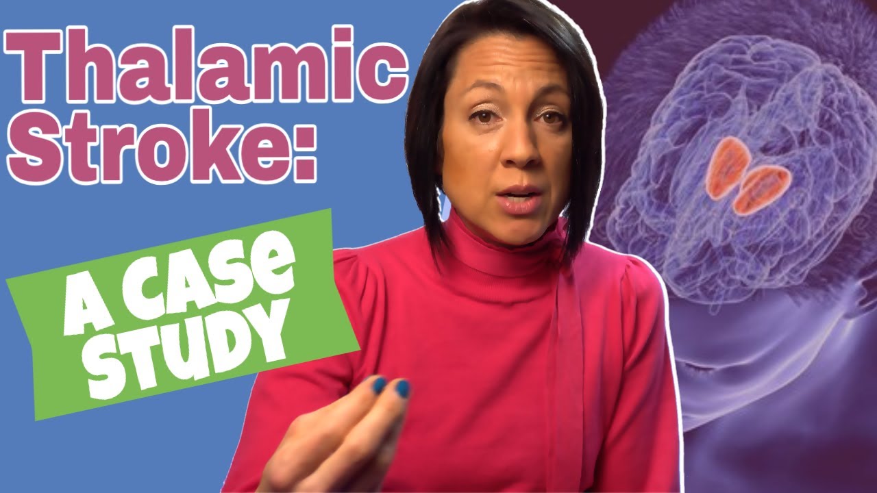 Thalamic Stroke Recovery Program - YouTube