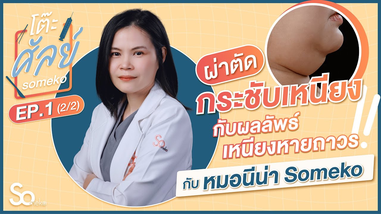 โต๊ะศัลย์ Someko | EP.1 [2/2] ผลลัพธ์สุดปัง!!! หลังผ่าตัดกระชับเหนียง กับหมอนีน่า Someko - YouTube