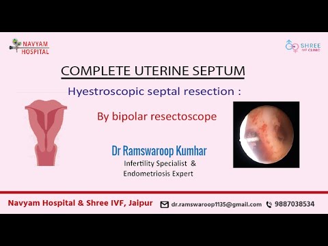 Hysteroscopic Septal Resection: complete Uterine Septum - YouTube