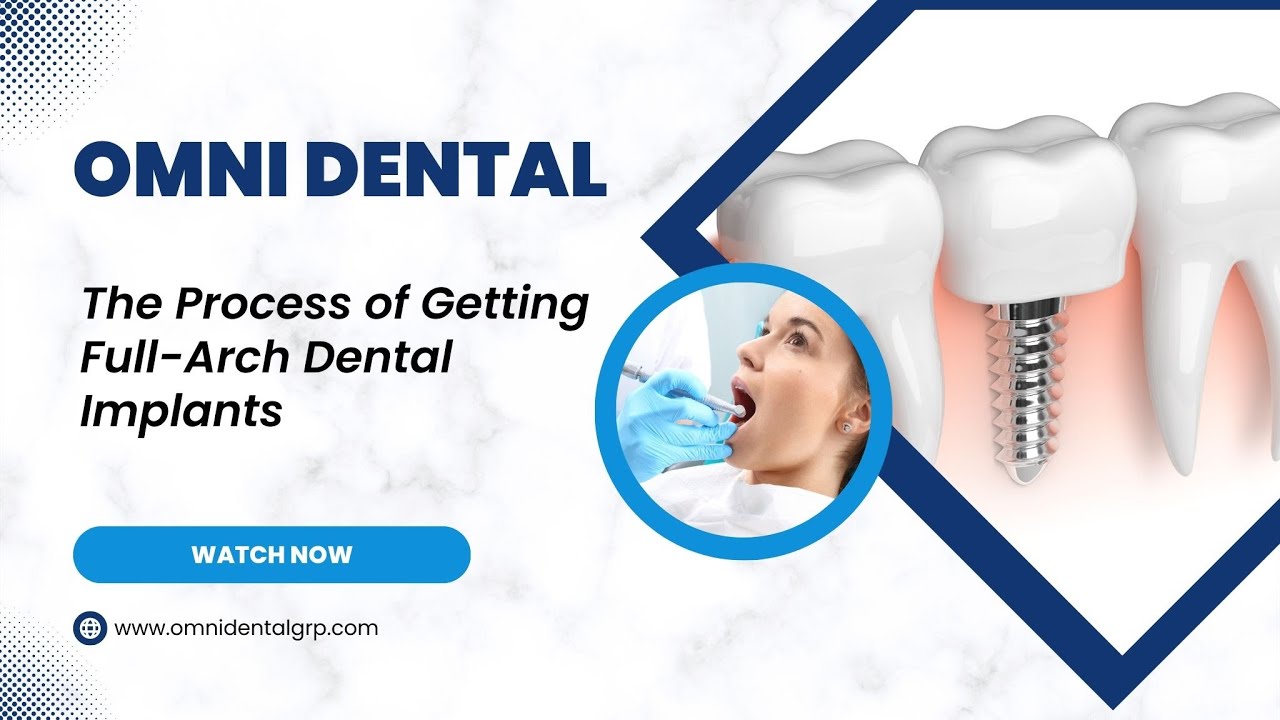 Full-Arch Dental Implant Procedure: Step-by-Step Guide | Omni Dental ...
