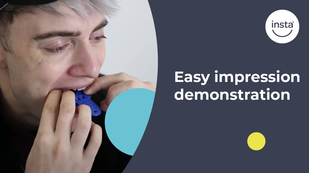 MUST WATCH - EASY instasmile impression demonstration - YouTube