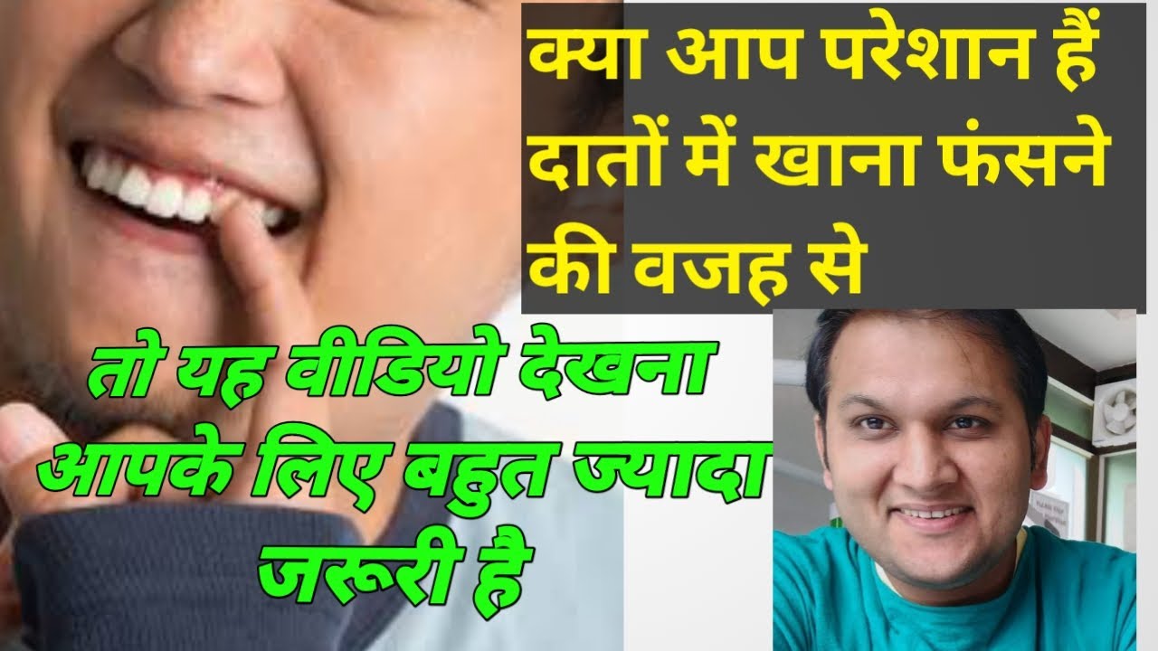 क्यों भोजन के टुकड़े दांतों के बीच फंस जाते हैं?|| Food lodgement ...