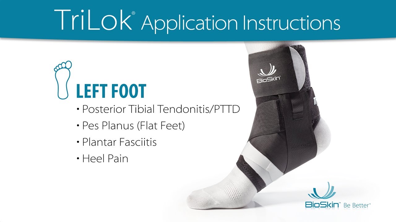 TriLok - LEFT foot application for PTTD, Flat Feet, Plantar Fasciitis ...