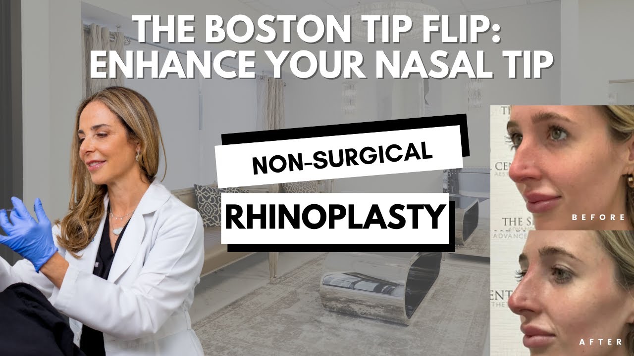 Boston Tip Flip: The Non-Surgical Nose Job You MUST Know About - YouTube