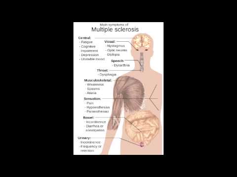 Multiple Sclerosis - Clinical Presentation - YouTube