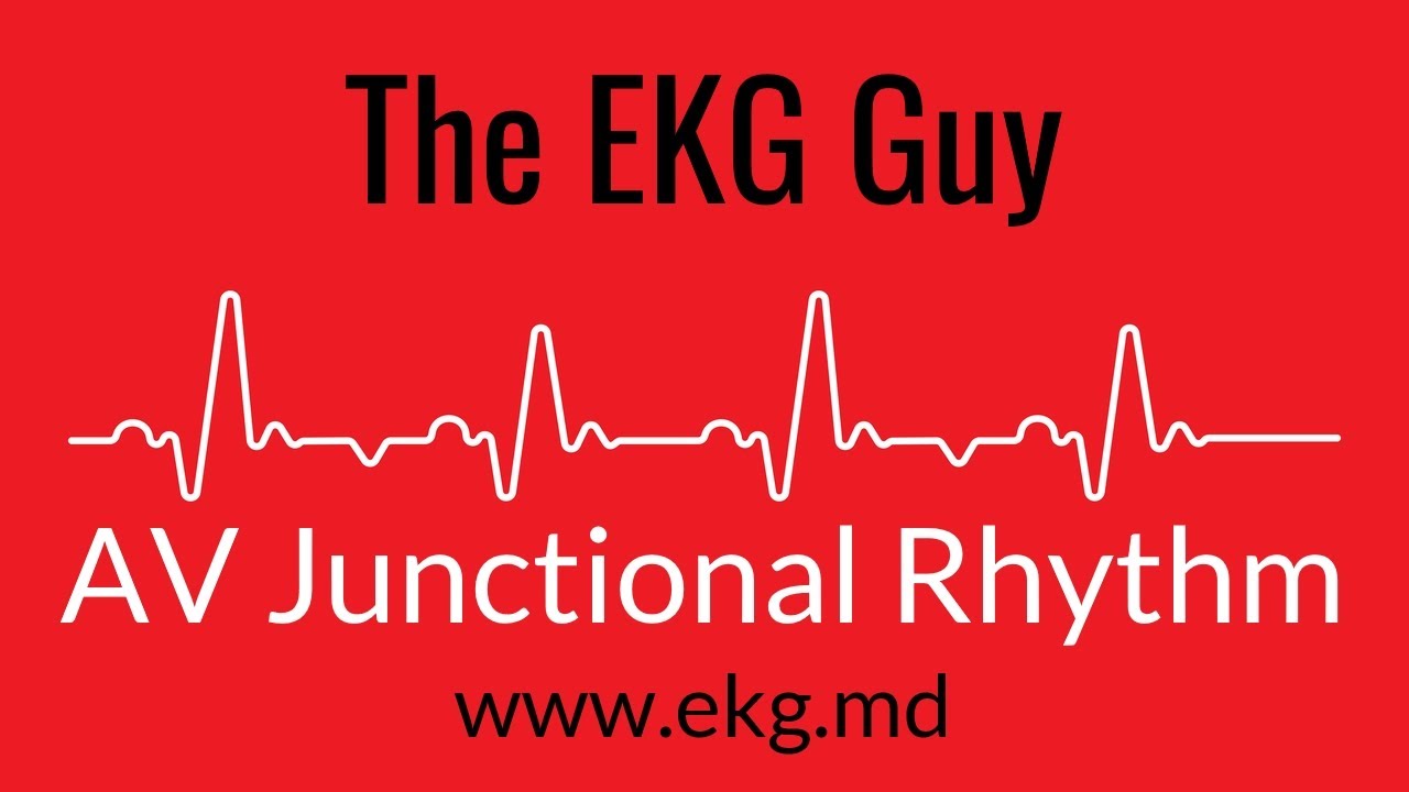 AV Junctional Rhythm EKG l The EKG Guy - www.ekg.md - YouTube