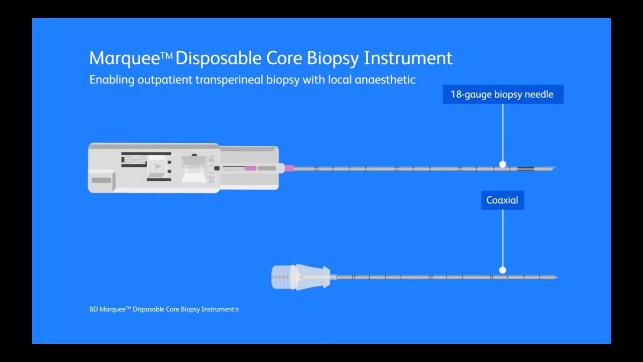 LATP Fully Freehand Prostate Biopsy Animation - YouTube