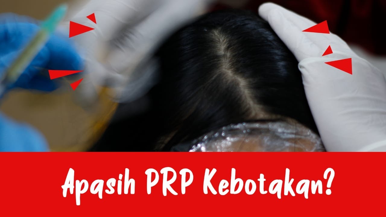 Perawatan rambut Kepala Platelet Rich Plasma (PRP) Untuk Mengatasi ...