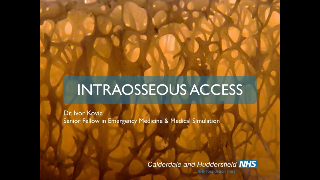Intraosseous access - YouTube